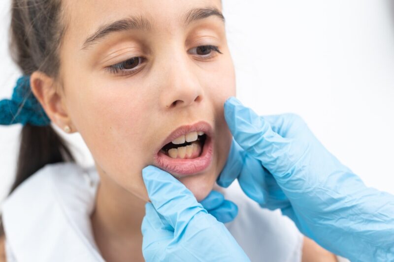 SLMB Medicaid Explained: Eligibility and Benefits