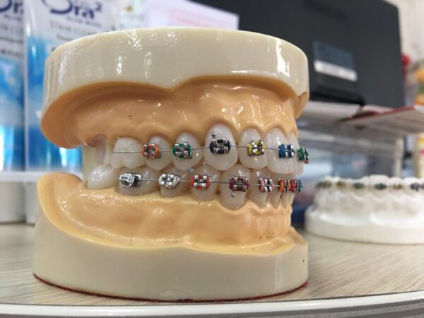 Why Choose Connex Medicare for Better Healthcare - Get a Quote and ...